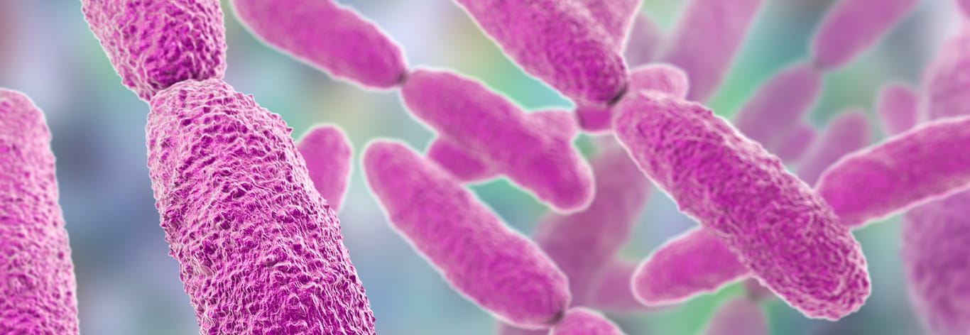 Hydrogen peroxide and peracetic acid: a new kid on the automated room ...