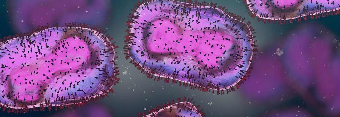 Monkeypox and the need to focus on environmental hygiene - GAMA Healthcare